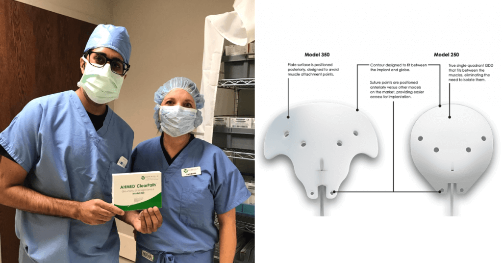 New Glaucoma Treatment Available at Georgia Eye Partners