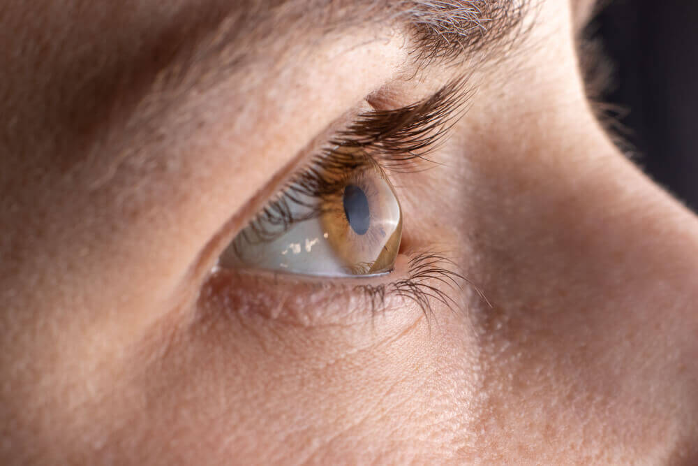 Corneal Disease Treatment Atlanta | Corneal Disease Duluth